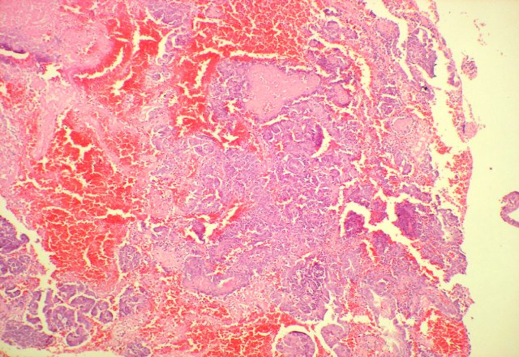 Normal Menstrual Cycle | www.shameempathology.com